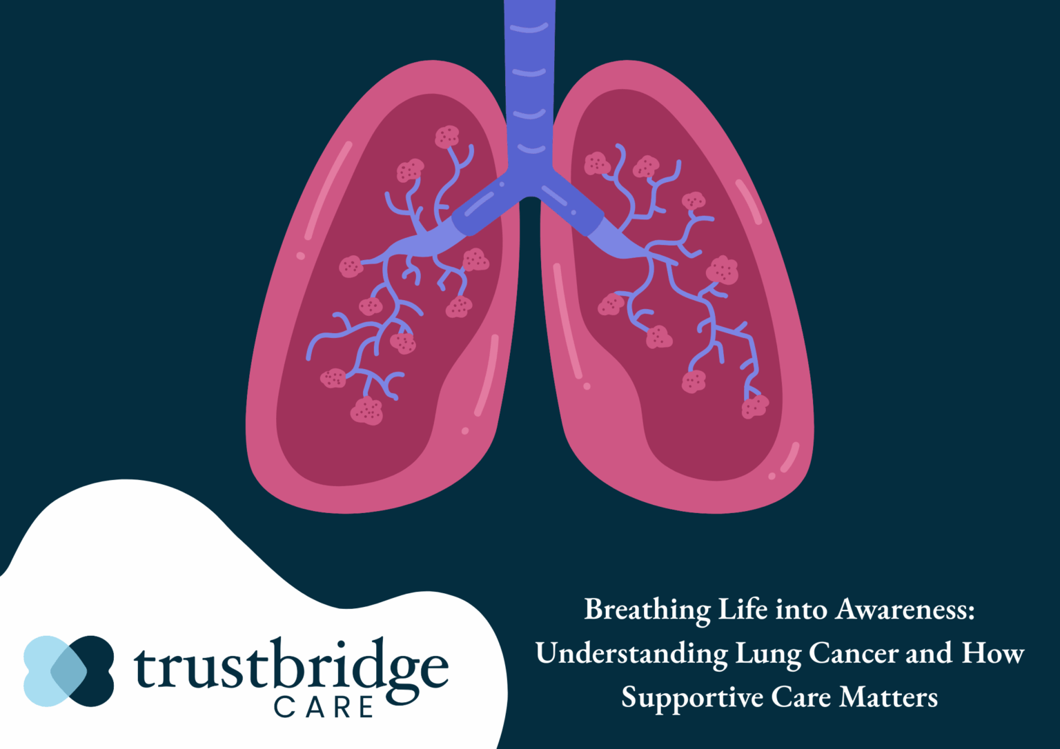 Breathing Life into Awareness: Understanding Lung Cancer and How ...